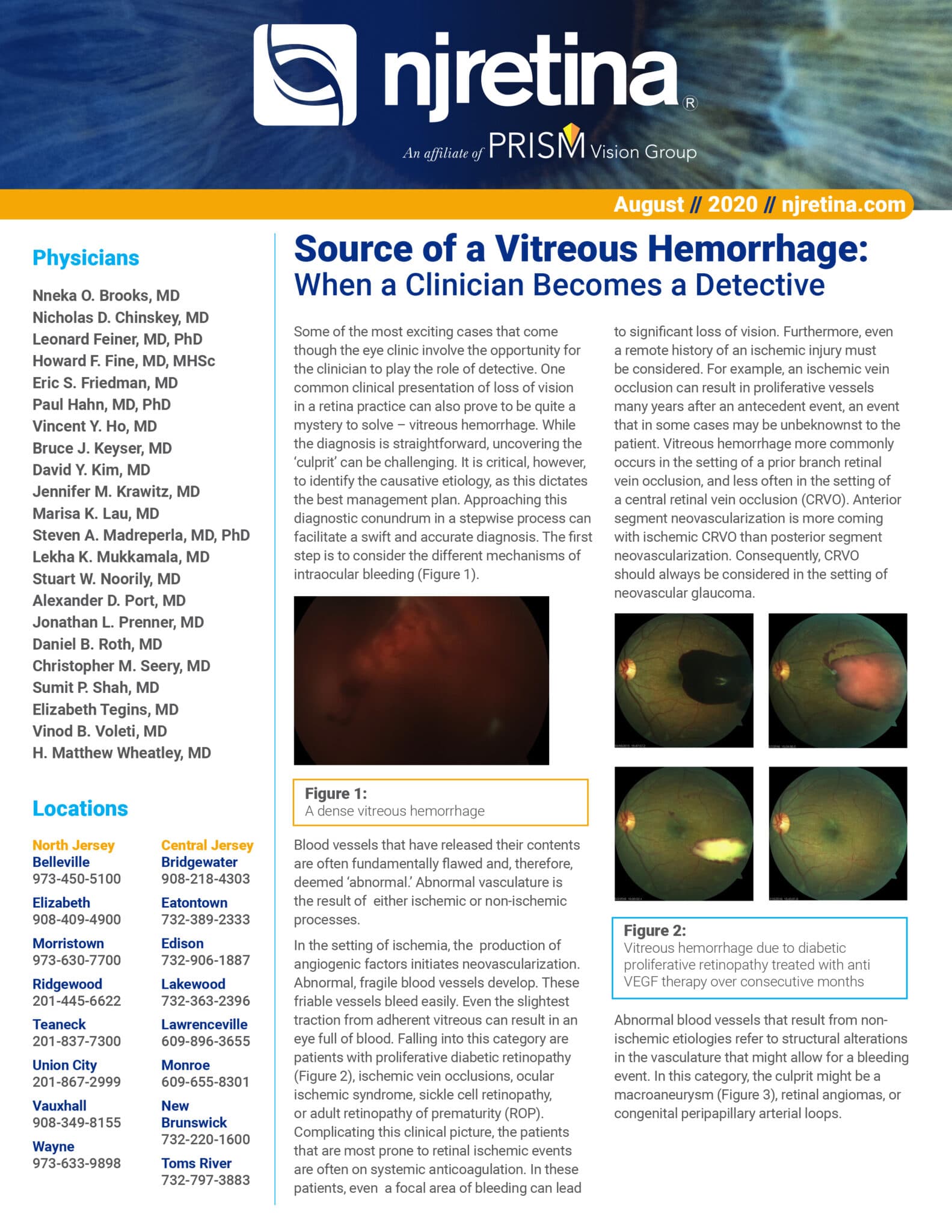 NJRetina August 2020 Newsletter - NJRetina